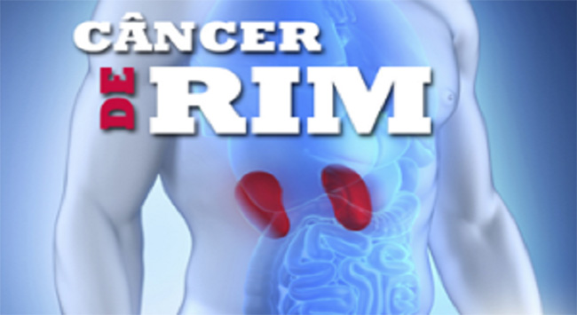 Câncer de rim: no dia de conscientização da doença, especialista alerta ...